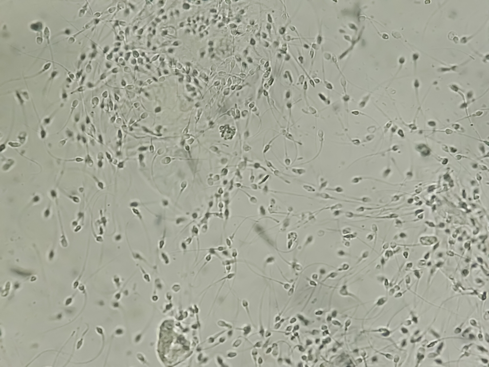 Semen Under Microscope